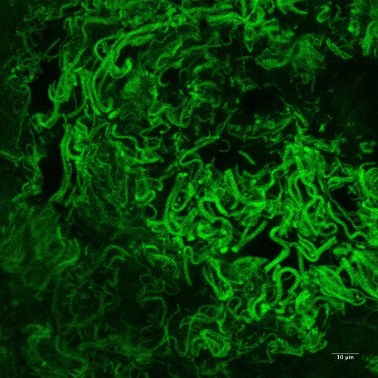 Using Our Own Bacteria to Treat Eye Disorders - Eye & Ear Foundation of ...