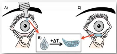 Eye Drops and the Future of Drug Delivery in the Eye - Eye & Ear ...