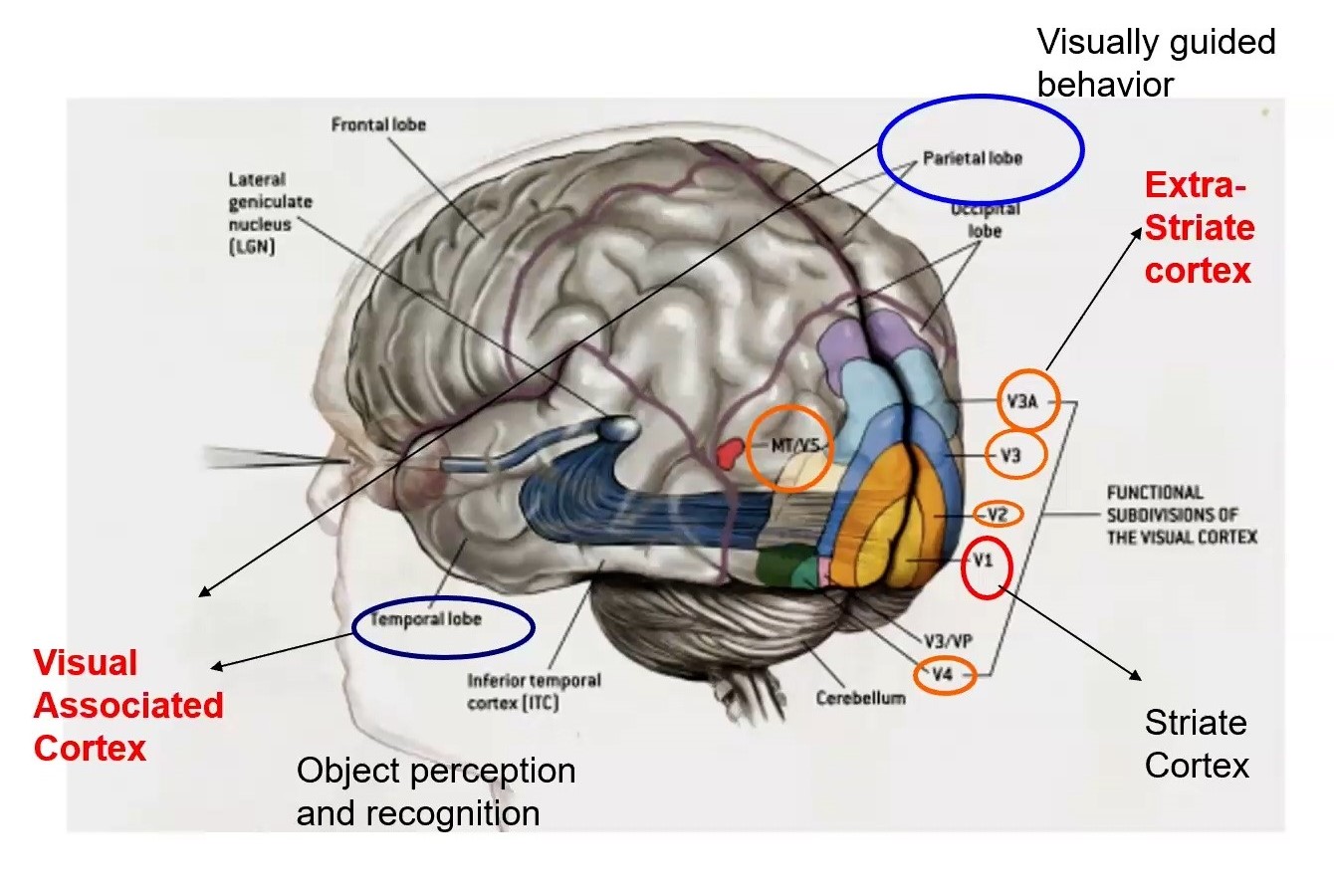 Cerebral Visual Impairment - Eye & Ear Foundation of Pittsburgh