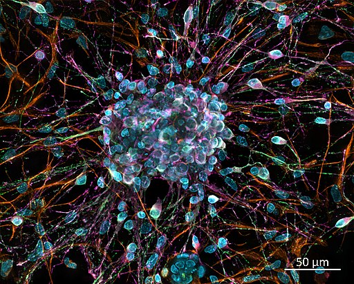 Published Study on Cortical Neuron Firing Patterns - Eye & Ear ...