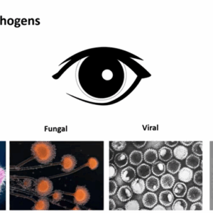 Herpes simplex virus keratitis Archives - Eye & Ear Foundation of ...